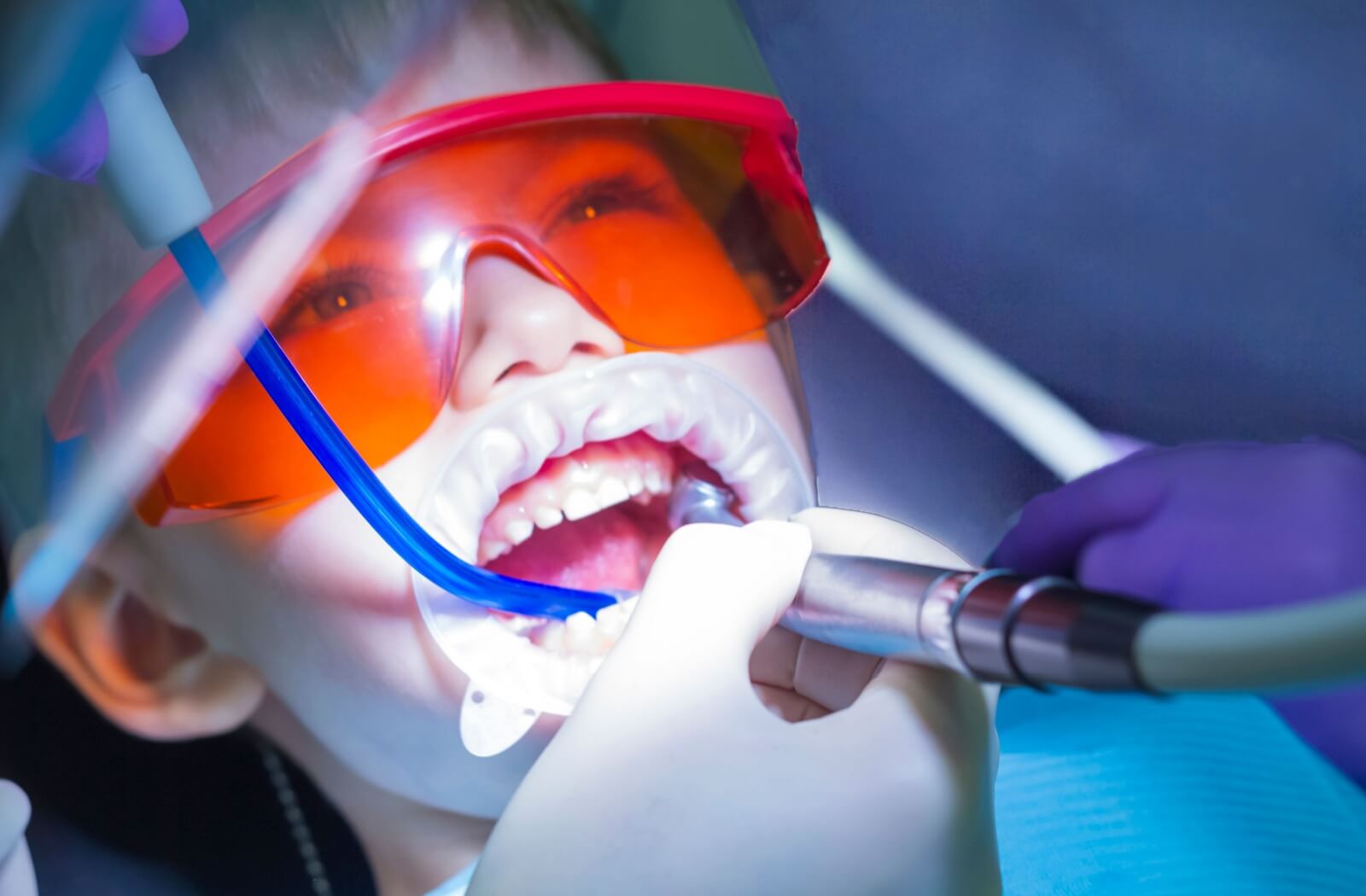 What Is Painless Dentistry? | Leduc, AB
